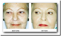 FDA Clears The DPL (Deep Penetrating Light) Therapy System For Over-the ...